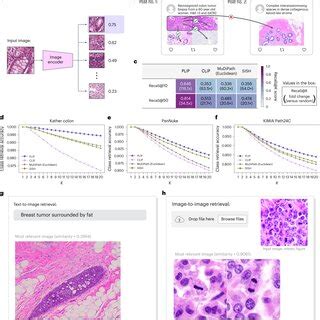 A Visuallanguage Foundation Model For Pathology Image Analysis Using Medical Twitter Request PDF