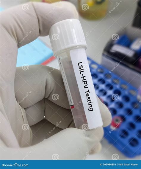 Vaginal Fluid Sample For Cervical Cancer Screening Co Testing Human Papilloma Virus Cervical