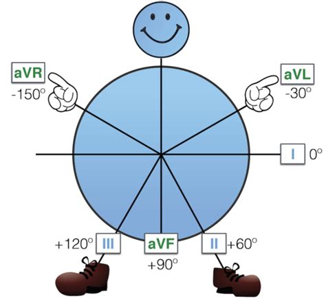Super Axis Man Sam • Litfl • Ecg Library Basics