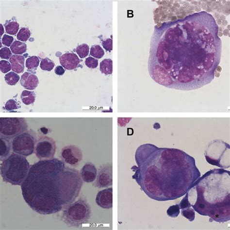 Cell Populations Of A Normal And Activated Csf Cell Picture A Normal
