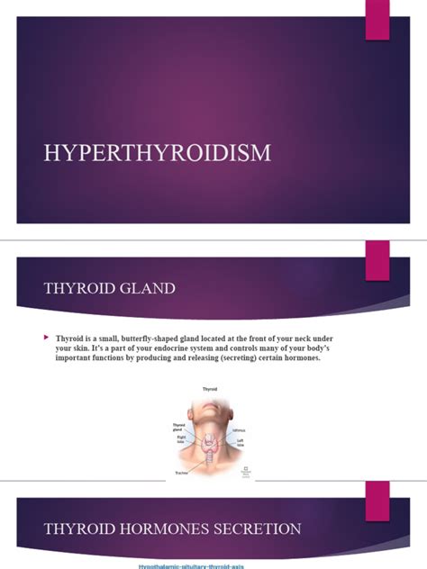 Hyperthyroid Is M Download Free Pdf Thyroid Hyperthyroidism