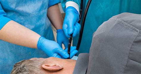 انجام موفقیت‌آمیز عمل Ercp در بیمارستان شهید بهشتی همدان ایسنا