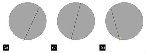 Intraoperative Radiality Assessment A Non Radial Suture Forming An