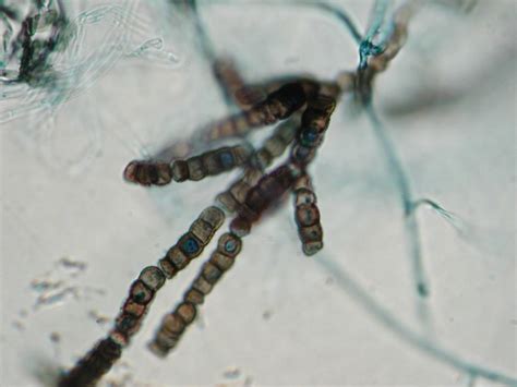 Molde De Aureobasidium Pullulans Aureobasidium Pullulans Life Cycle