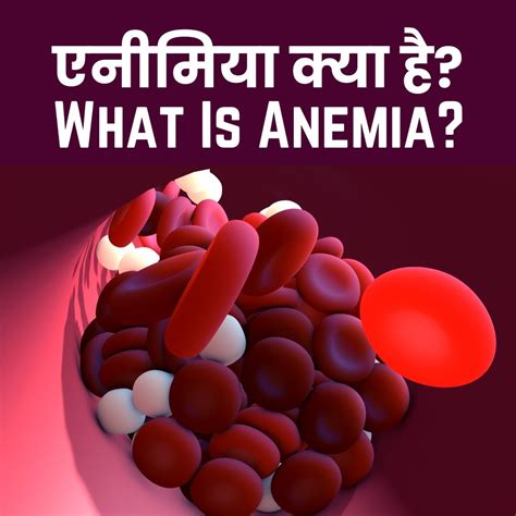 Anemia Disease Archives Manthan Hospital
