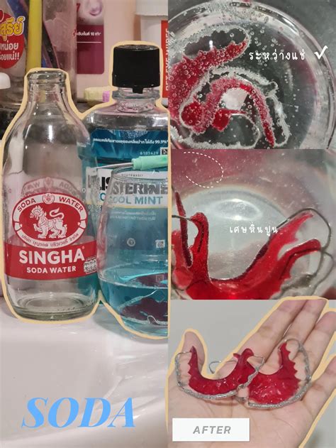 มาดูกันว่าใช้อะไรแช่รีเทนเนอร์ ได้บ้าง แกลเลอรีที่โพสต์โดย Pp Papit Lemon8