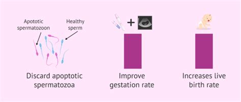 Benefits Of Performing The MACS Technique