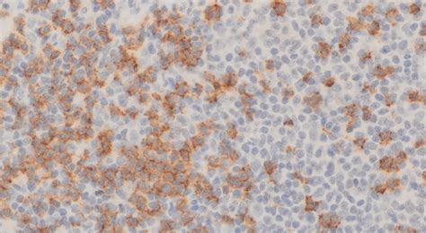 Human Tonsil Tissue Normal Ffpe Sections