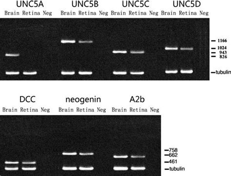 Unc5h2unc5b Antibody Unconjugated Af1006 Novus Biologicals