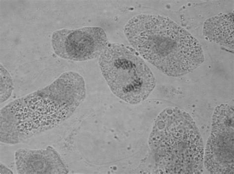 A T With Lagging Chromosomes Pr64a83 Cultivar 01 Caffeine Download Scientific Diagram