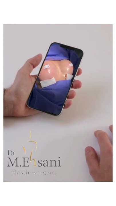 کلینیک زیبایی دکتر احسانی Youtube