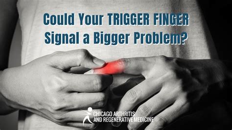 Could Your Trigger Finger Signal A Bigger Problem Chicago Arthritis