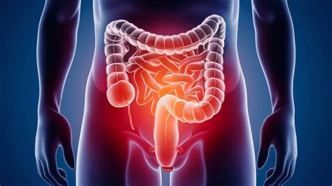 Rectal Cancer Causes Symptoms Treatment And Prevention