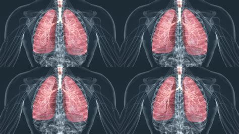 呼吸系统 支气管炎 肺功能 肺活量动画 视频素材下载
