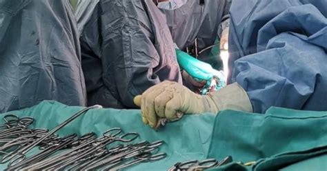 Лекари в Полша отстраниха яйчникова киста с тегло близо 100 кг Новини от Dnes Bg