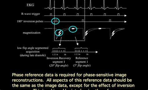 MRI BLOG Phase Sensitive Inversion Recovery