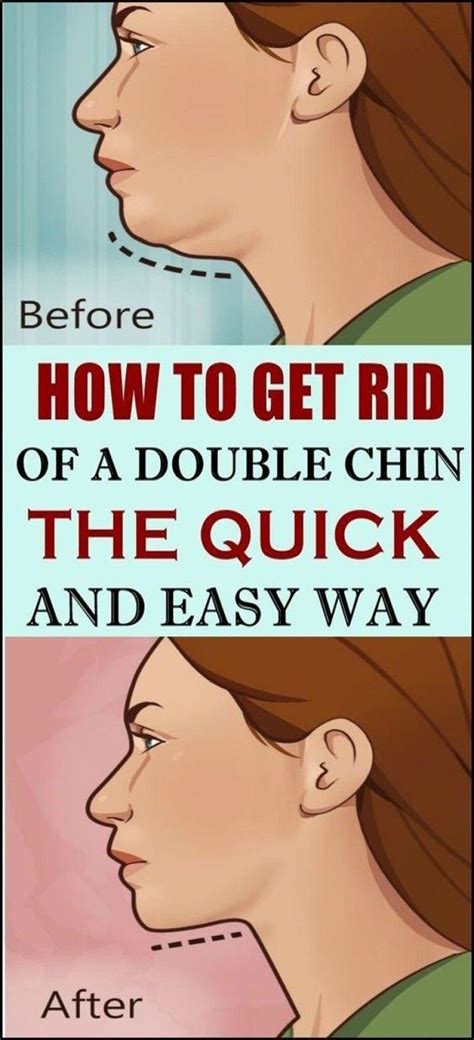 How To Get Rid Of A Double Chin The Quick And Easy Way Double Chin Health Tips Fitness Tips