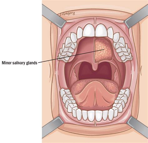 Oral Salivary Gland Cancer ‣ Anatomy
