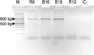 Detection Of The AcdS Gene By PCR In Selenium Tolerant Bacteria Download Scientific Diagram
