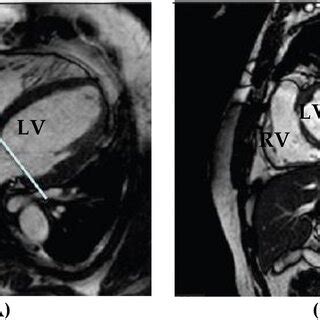 The Final Result Of RV Segmentation The First Raw Displays The Download Scientific Diagram