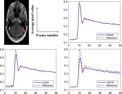 Comparison Of The Reconstructed Contrast Agent Concentration Time Download Scientific Diagram