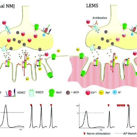 Diagnostic Algorithm For Myasthenia Gravis Mg Having Identified