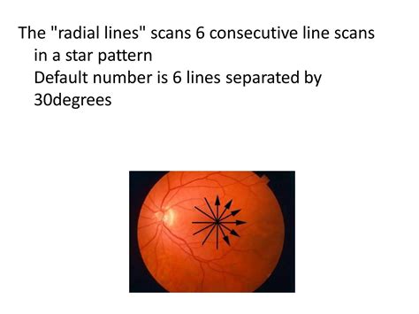 Optical Coherence Tomography Oct Macula Pptx Eye And Vision