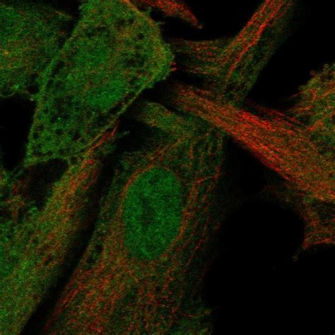 Rabbit Polyclonal Anti Stambp Antibody Buy For Research Highly Specific Rigorously