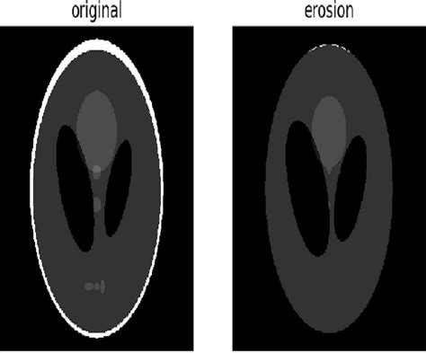 Figure 24 From Hardware Solution To Motion Object Detection Using Morphological Filtering And