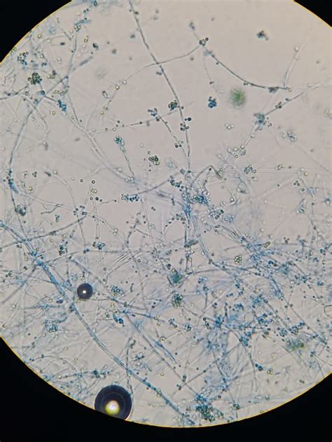 1475 Questions With Answers In Fungi Science Topic