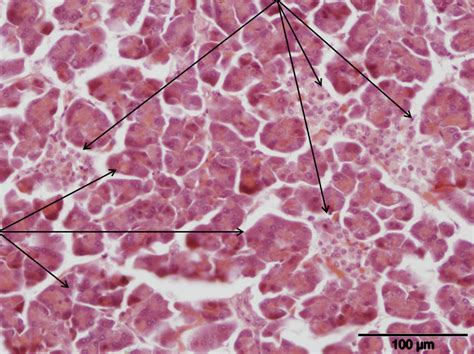 Pancreas Endocrine And Exocrine Diagram Quizlet