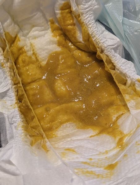 is this cmpa poo pic mumsnet