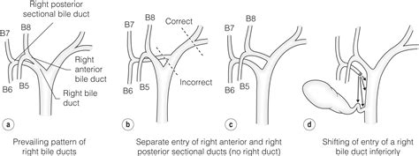 Hepatic Biliary And Pancreatic Anatomy Clinical Tree