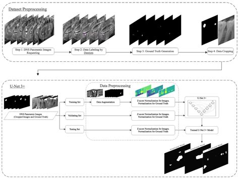 Detection Of Cavities From Dental Panoramic X Ray Images Using Nested U Net Models