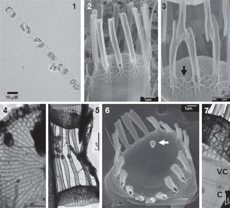 Skeletonema Sp Aff Japonicum Lm Sem And Tem 1 A Chain Of 6 Cells