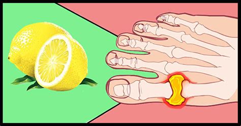 Natural Ways To Reduce Uric Acid In Your Body