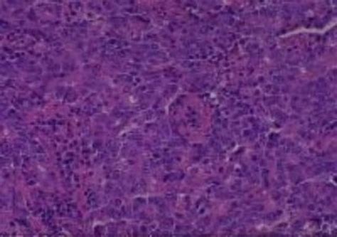 Novus Biologicals™ Human Multi Tissue Tissue Microarray Cancer Human