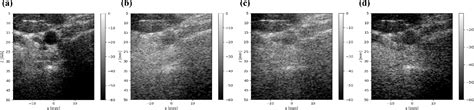 Figure From A Robust Deep Neural Network Approach For Ultrafast Ultrasound Imaging Using