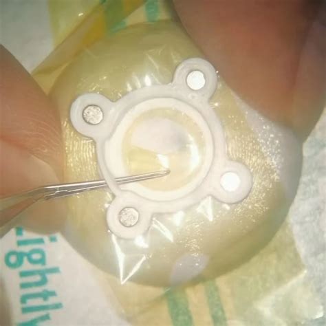 S20e9d885592f4136aeda110d6259e903e