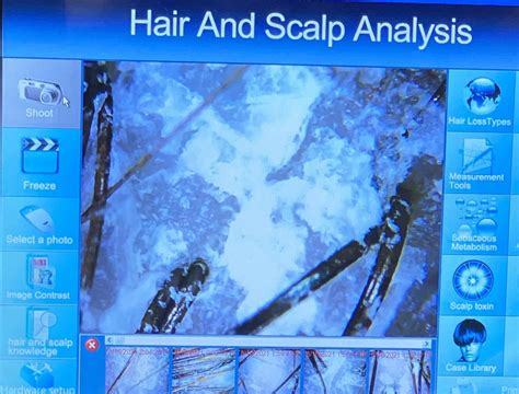 Hair And Scalp Analysis Rivafelis