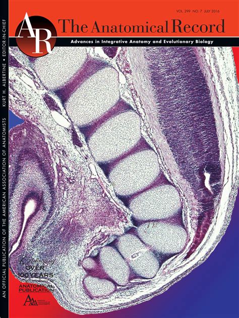 Median Sacral Artery Cadaver