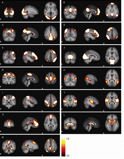 Figure 1 From Resting State Connectivity After Treatment With The Stress Hormone Cortisol