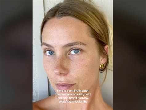 28 Year Old Mom Posted Her ‘raw Face To Normalise Aging But Got A Lot