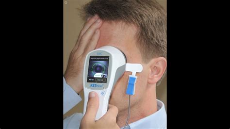 Electroretinography Cpt Code Simplify Medical Coding Youtube