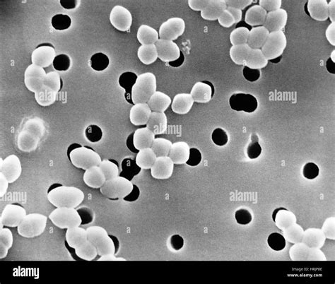Enterococcus In Urine Infection