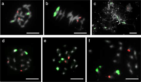Chromosomal Localization Of 45s Rdna Loci Green Fluorescence And 5s Download Scientific