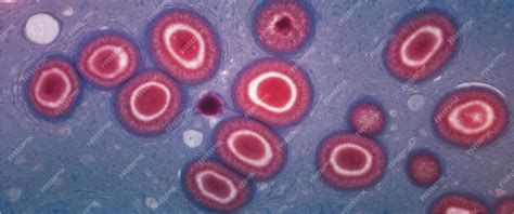 Premium Photo Brightfield Microscopy Image Showcasing Intricate Nerve Biopsy Cells