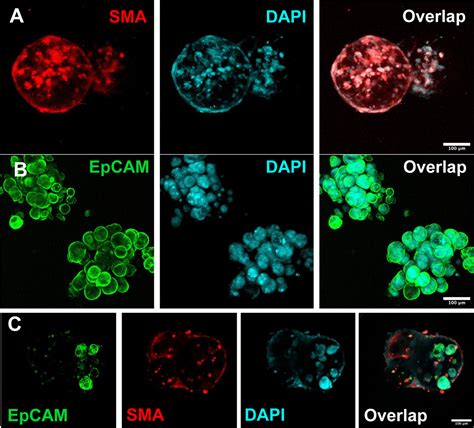 Microfluidic Droplet Assisted Fabrication Of Vessel Supported Tumors For Preclinical Drug