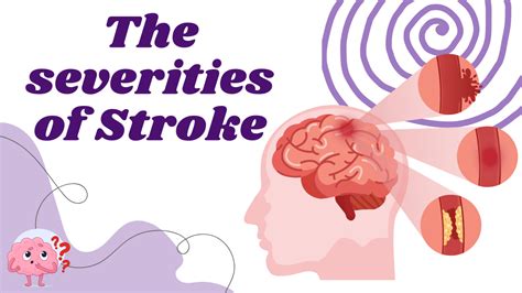 The Severities Of Stroke