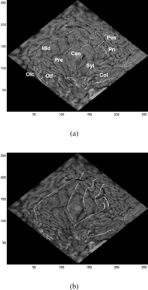 Figure 2 From Brain Warping With Implicit Representations Semantic Scholar
